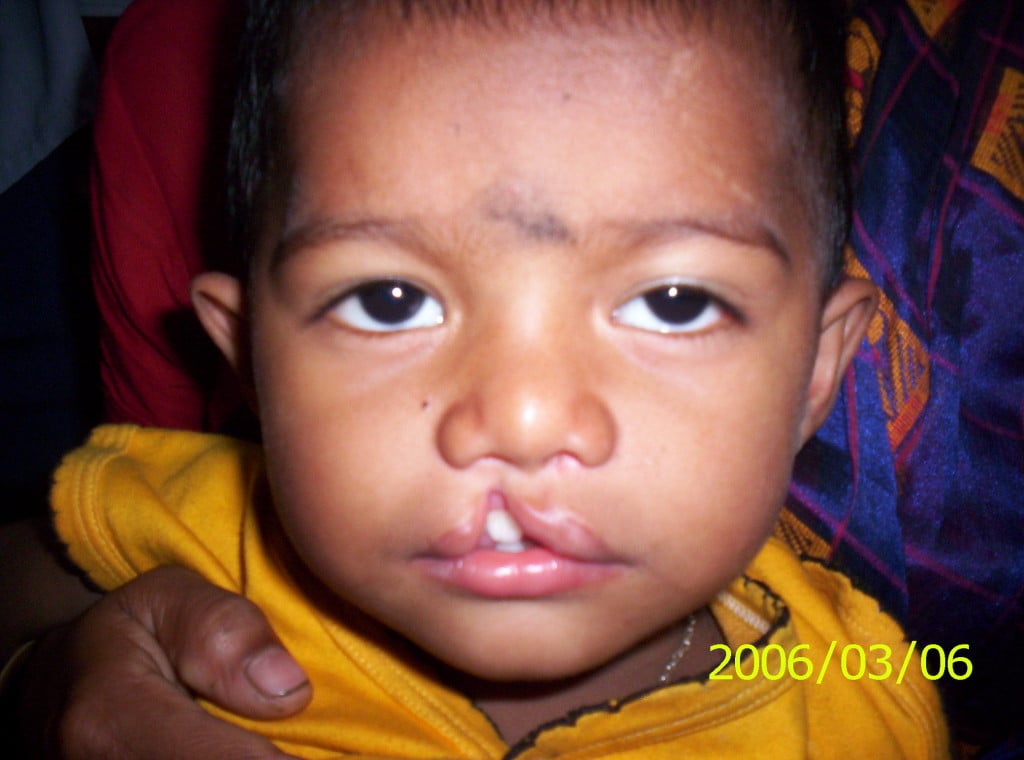 Congenital Anomalies – Gluten Free Works: TREATMENT GUIDE